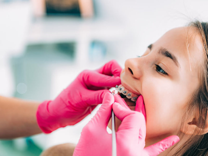 Pediatric Orthodontic Services | SNODGRASS-KING