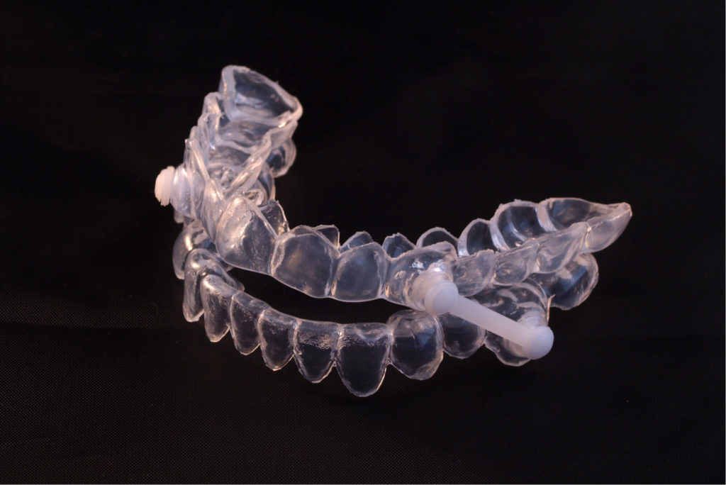 Oral Appliance Therapy | Snodgrass-King Orthodontics