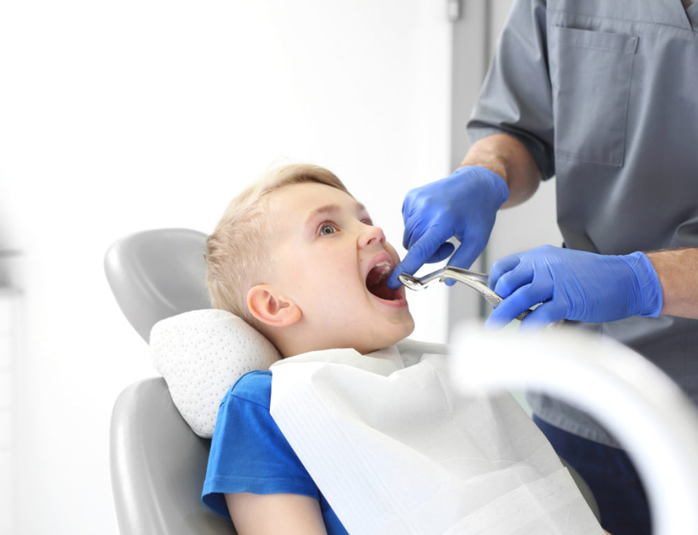 Frenectomy | Why It’s Needed and When to Fix Your Frenum in TN
